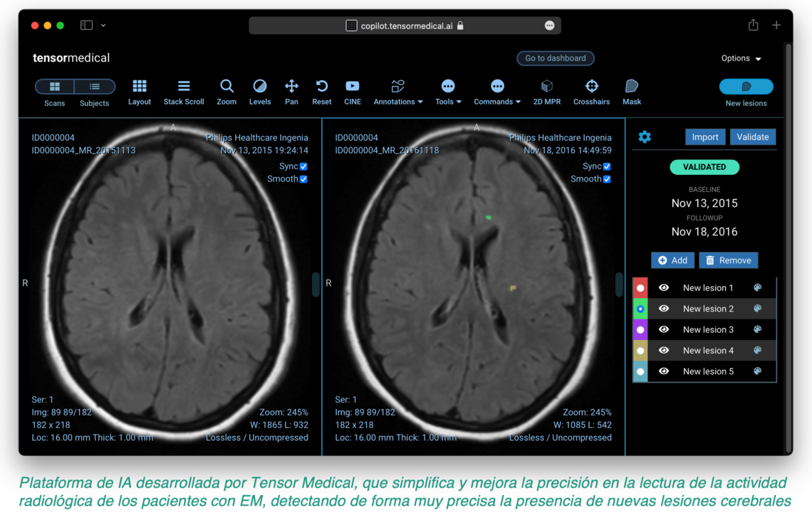 Tensor Medical | Capital Cell